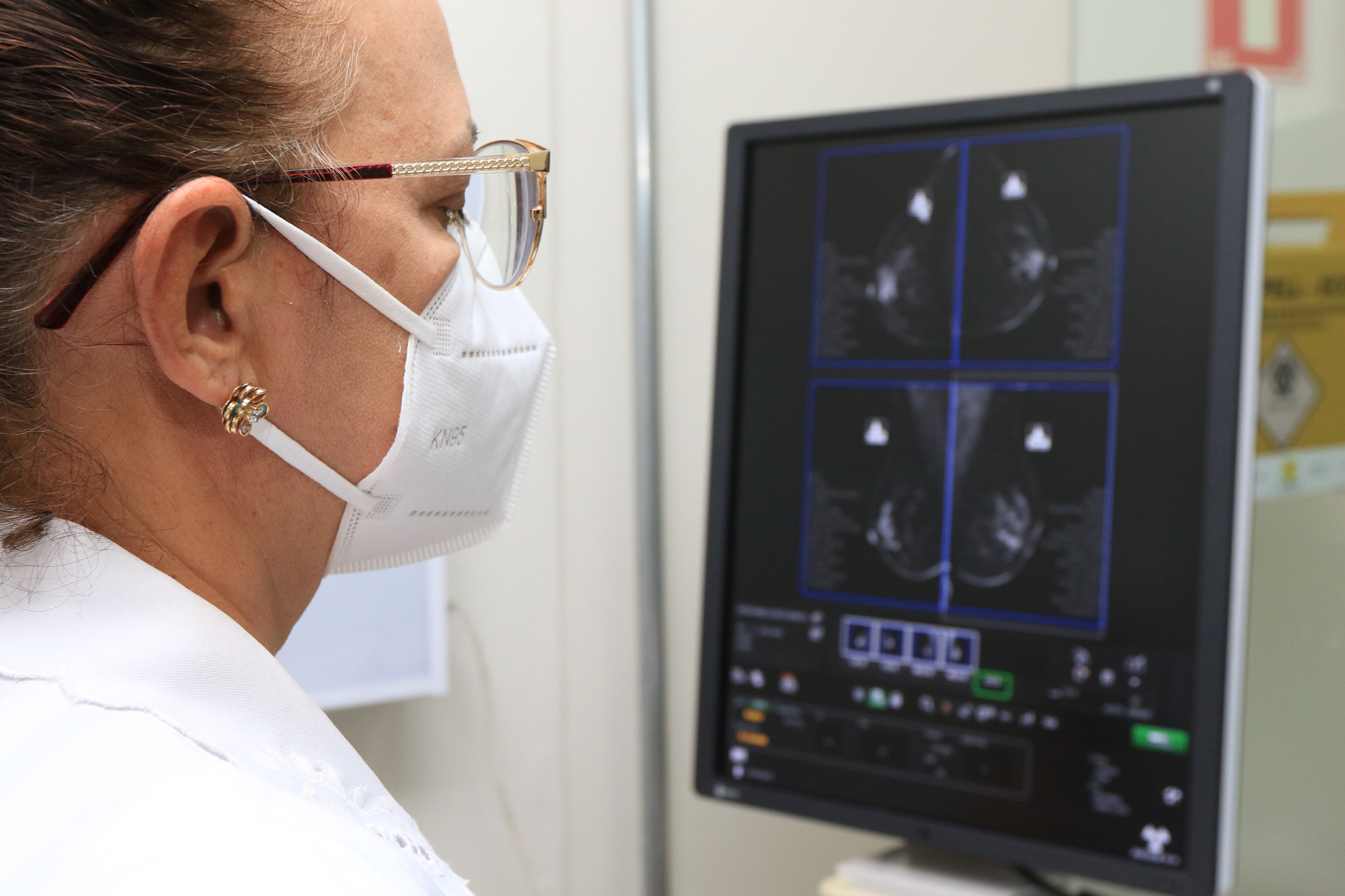 DF reduz fila de mamografia em mais de 70% com ampliação do serviço ...