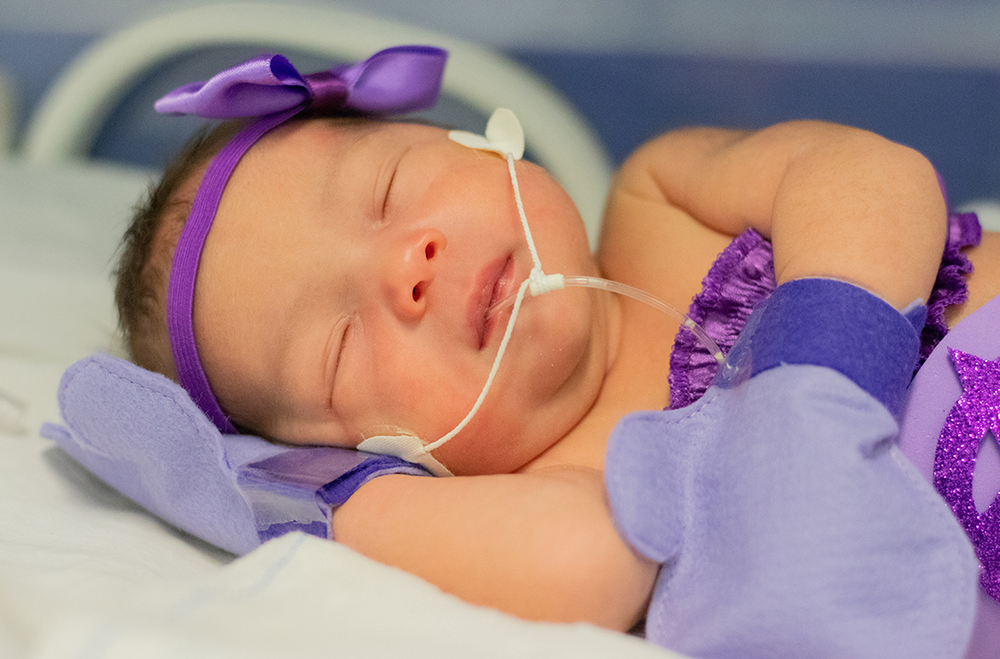 Bebês prematuros: ensaio fotográfico aproxima pais e filhos que ...